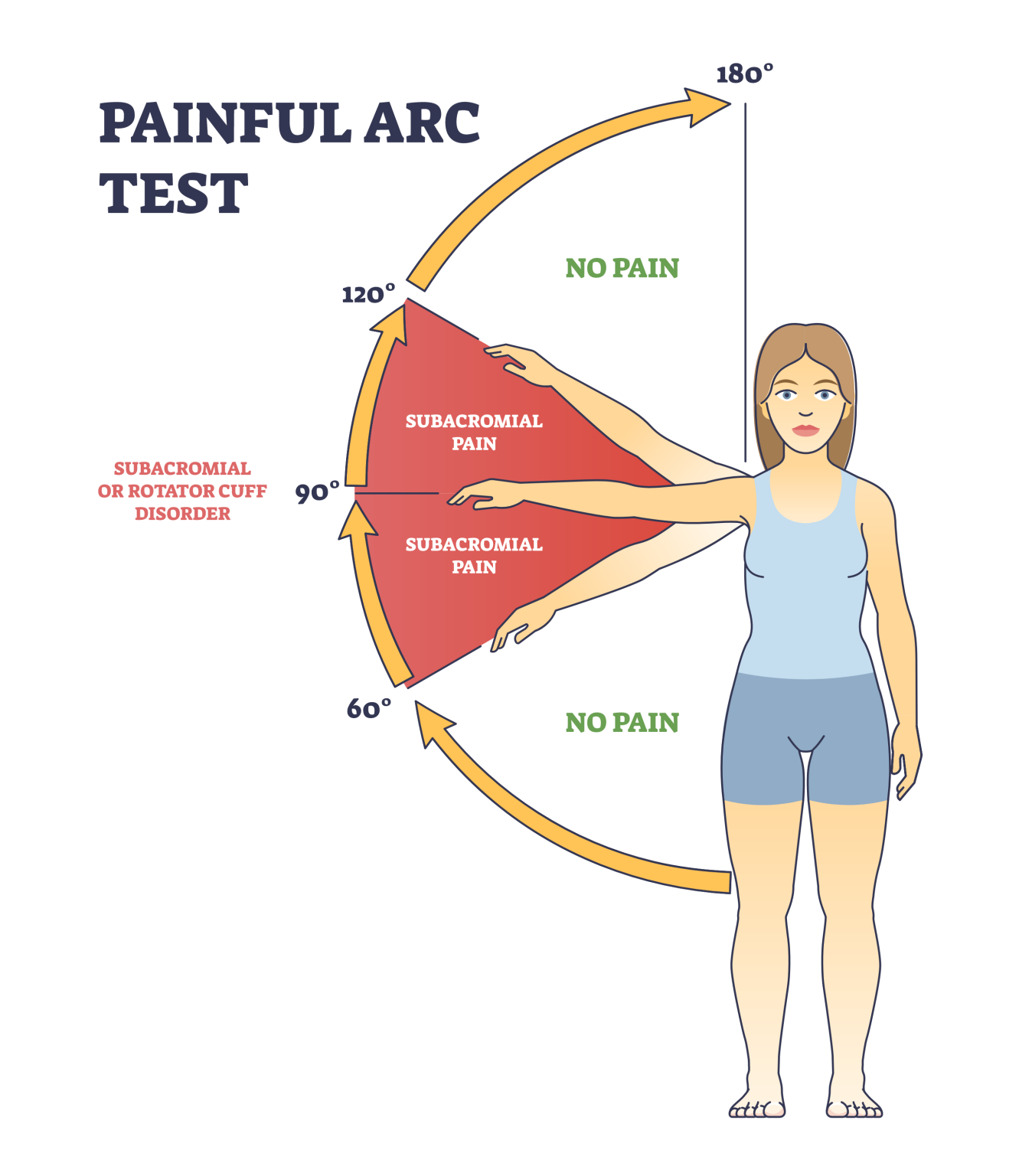 4 Best Rotator Cuff (Shoulder) Impingement Exercises (with Pictures ...
