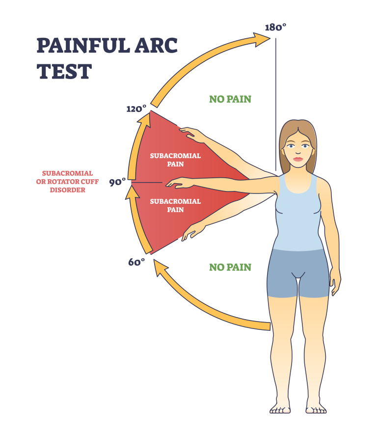 4 Best Rotator Cuff (Shoulder) Impingement Exercises (with Pictures ...
