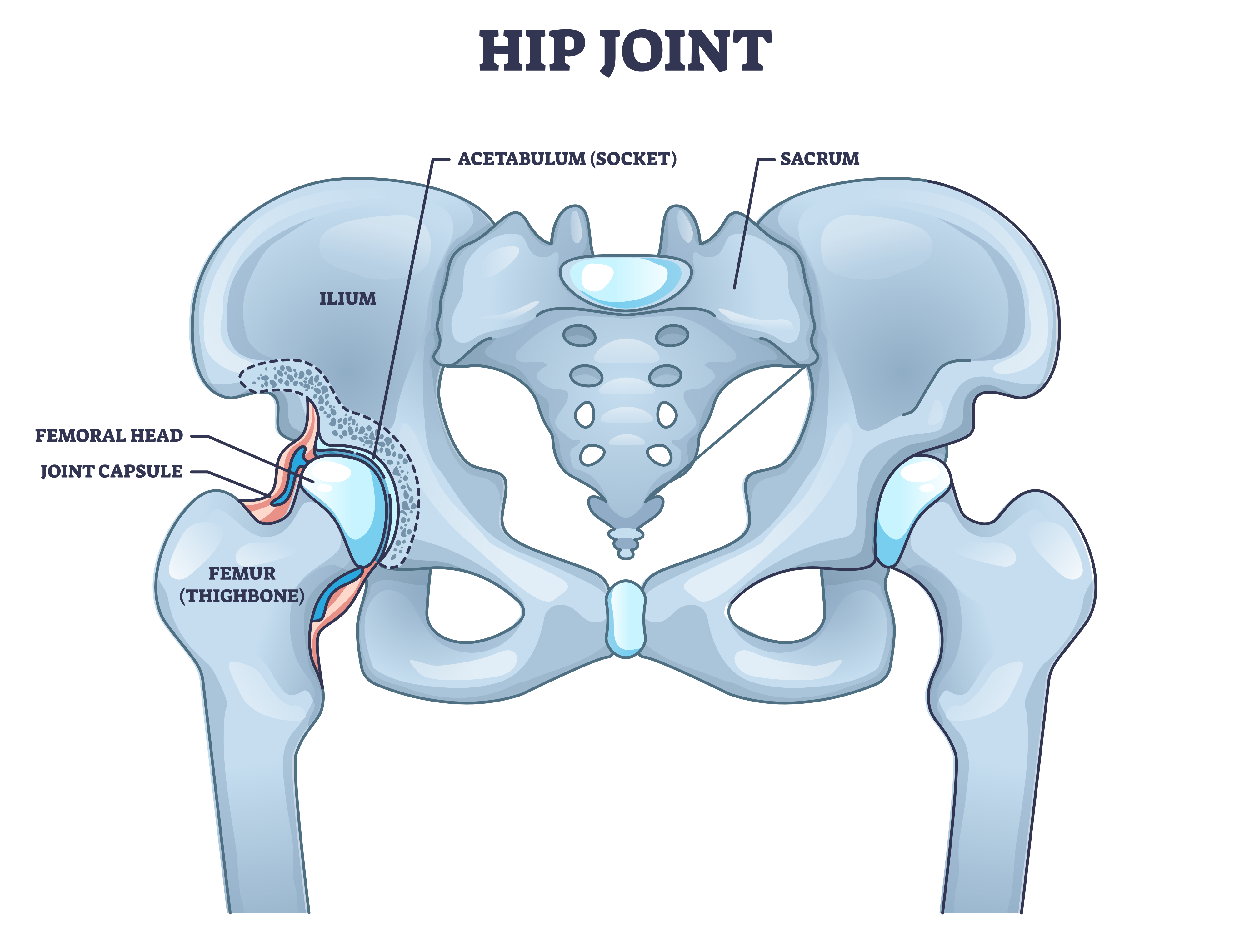 Hip Pain After Squats: Signs, Stretches, and More - Inspire US